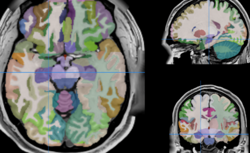 ASSEMBLYNET : Software providing segmentation of the intracranial ...